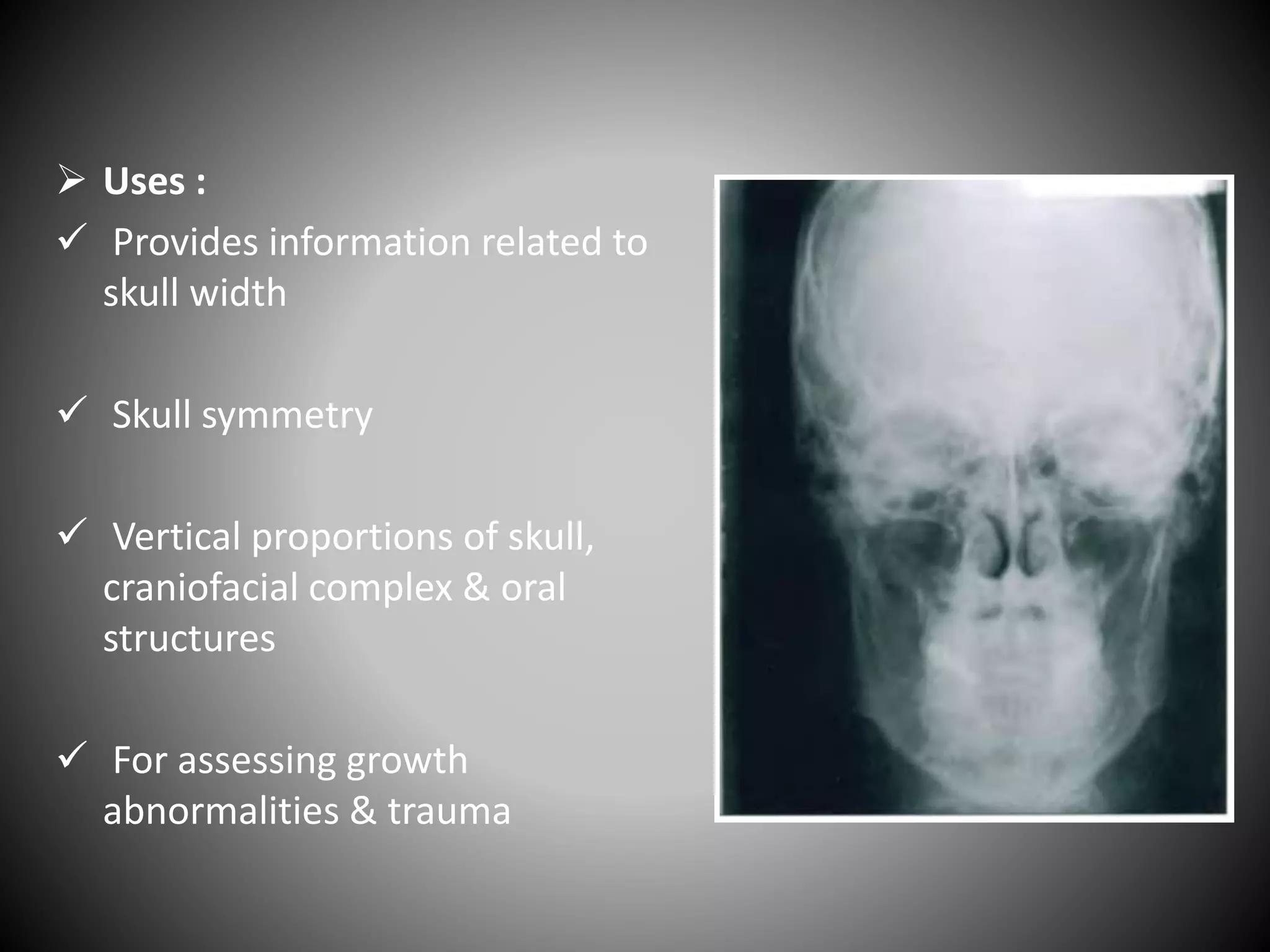 lateral cephalometry in orthodontics | PPTX
