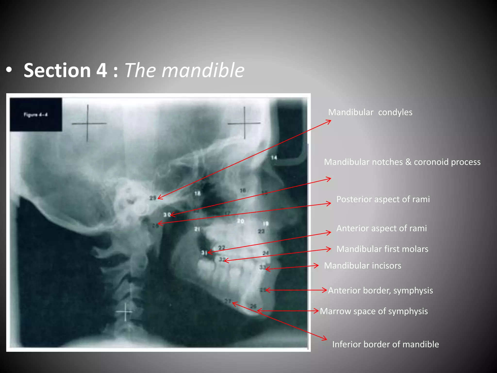 lateral cephalometry in orthodontics | PPTX