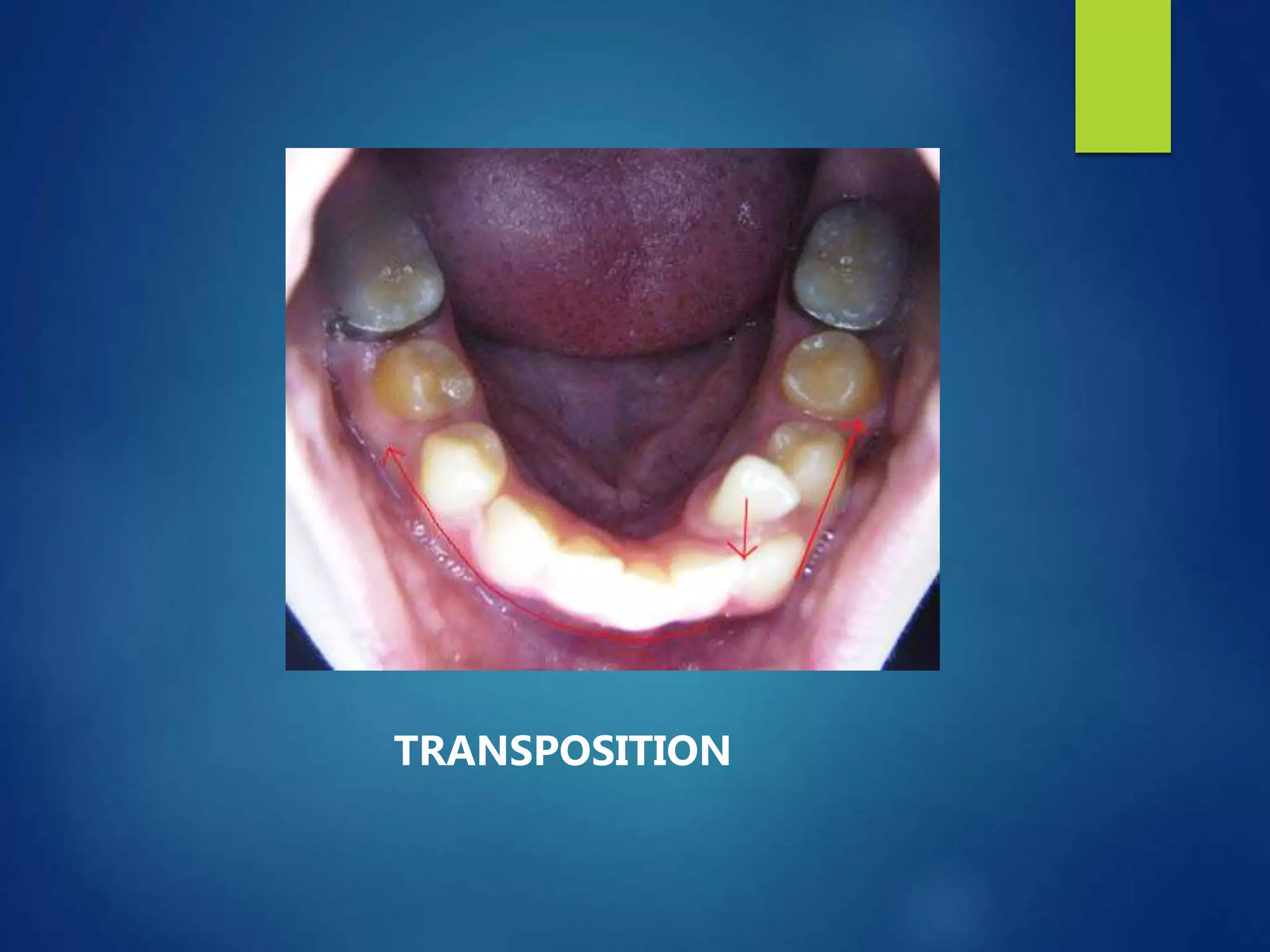 cast analysis | PPTX