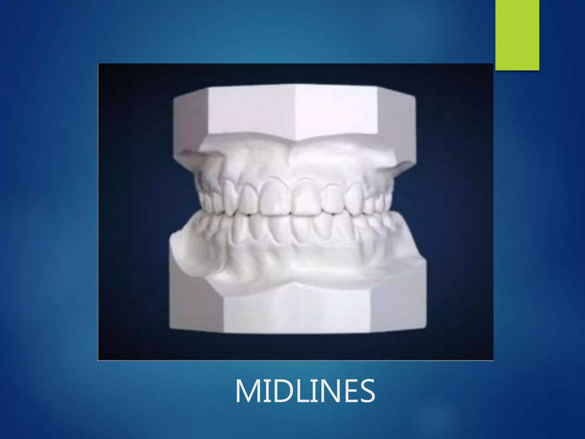 cast analysis | PPTX
