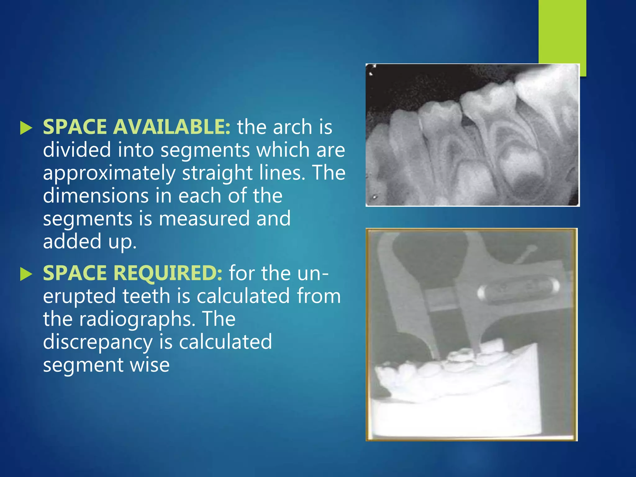 cast analysis | PPTX