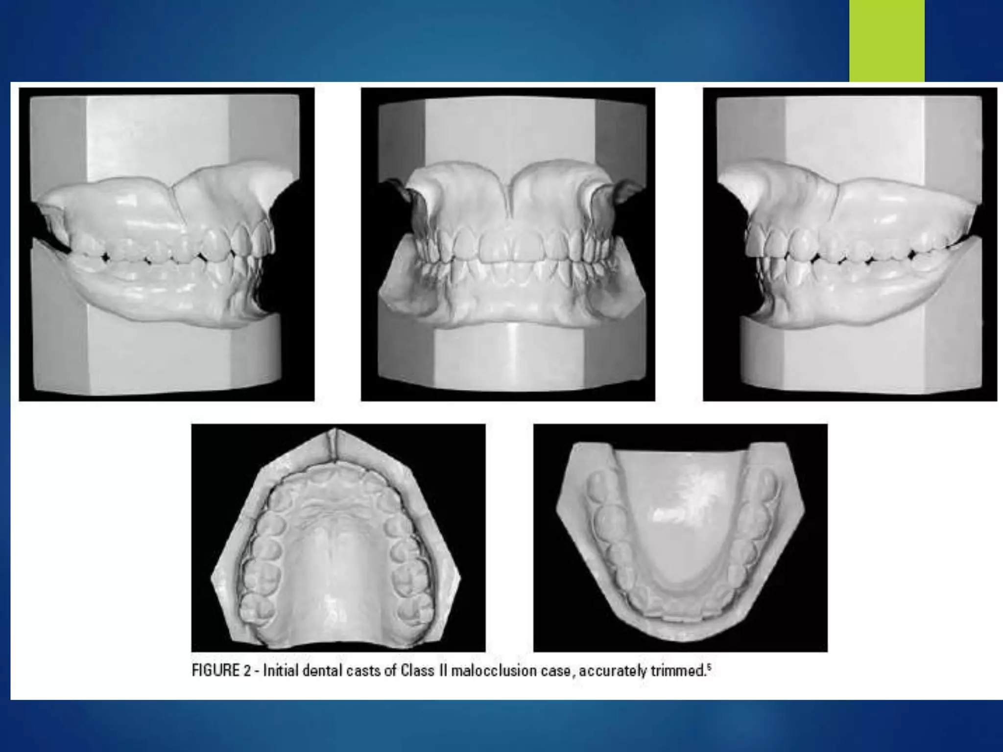 cast analysis | PPTX