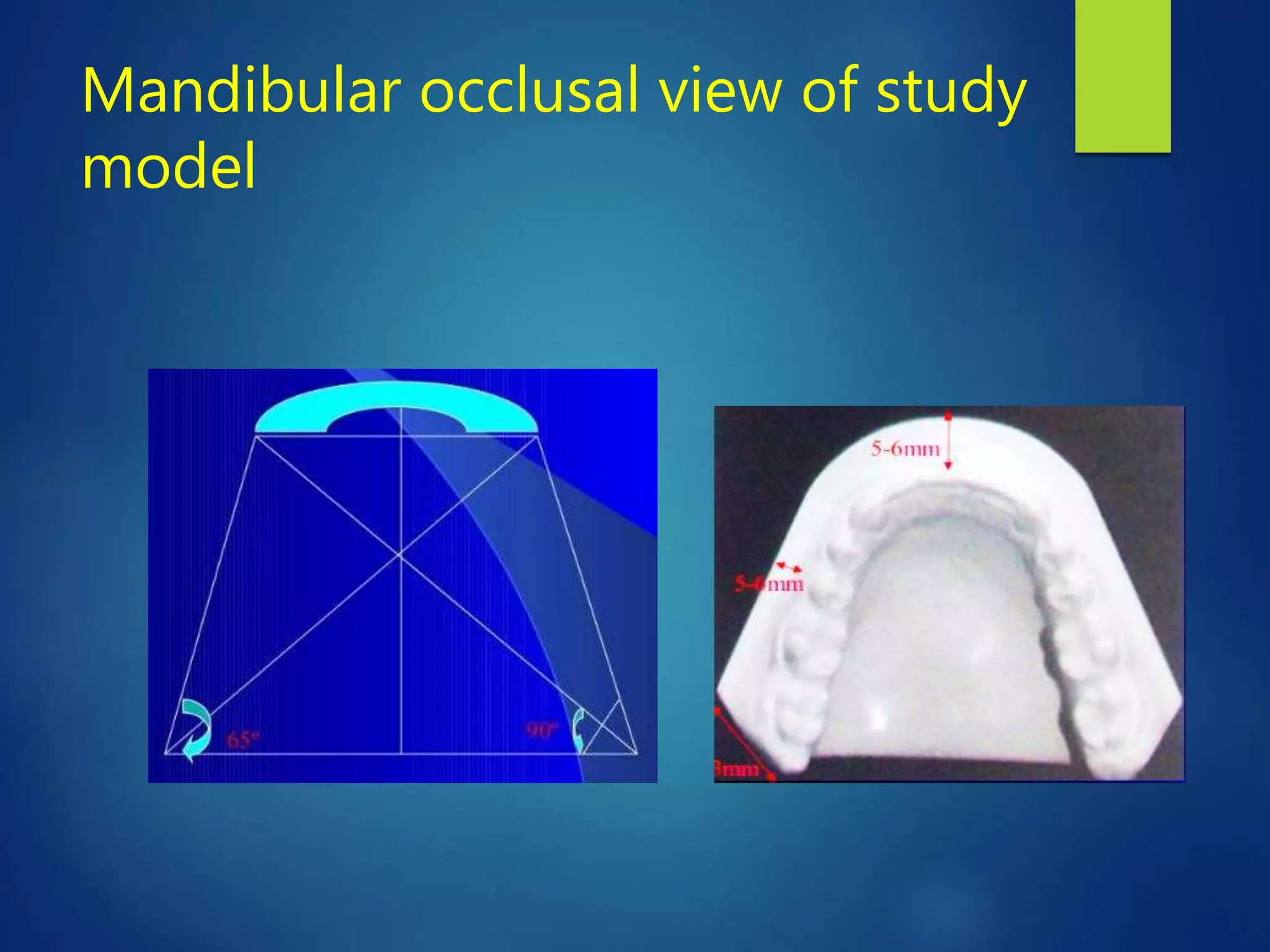cast analysis | PPTX