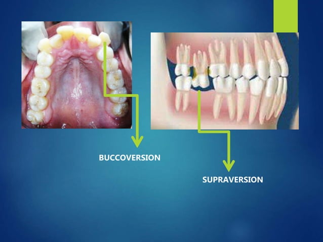 cast analysis | PPTX | Dental Health | Diseases and Conditions