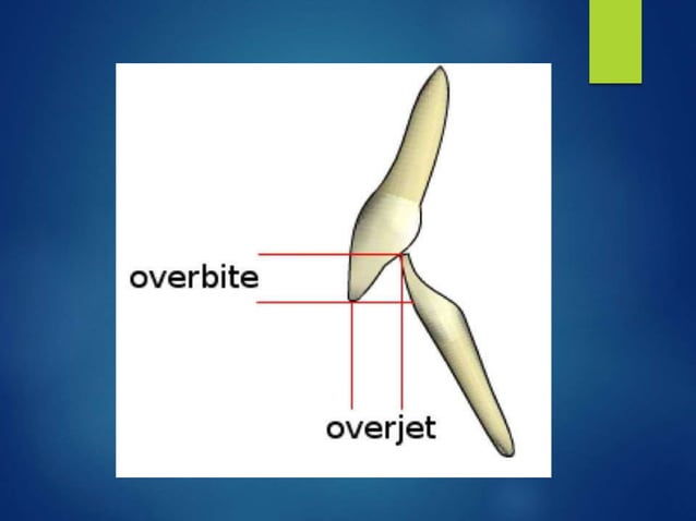cast analysis | PPTX | Dental Health | Diseases and Conditions