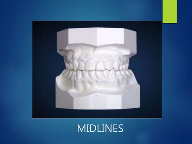 cast analysis | PPTX | Dental Health | Diseases and Conditions