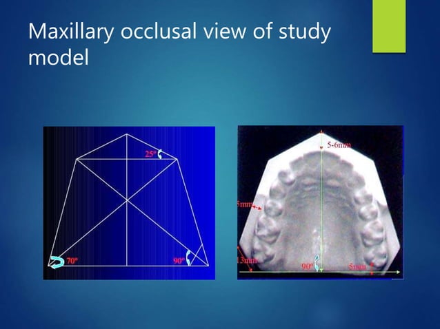 cast analysis | PPTX | Dental Health | Diseases and Conditions