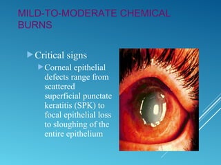 Occupational Eye Disorders | PPT