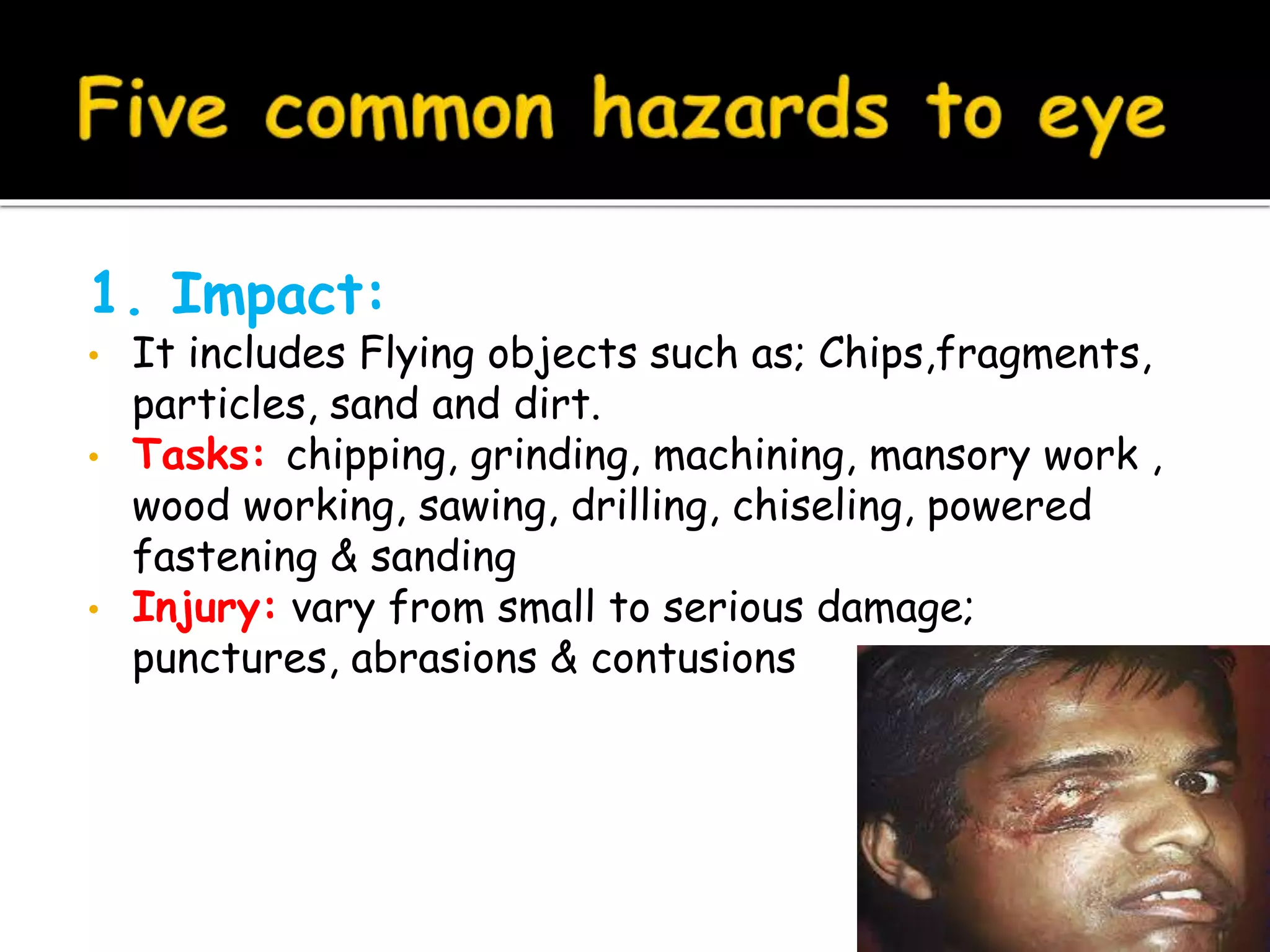 Ocular Hazards | PPTX