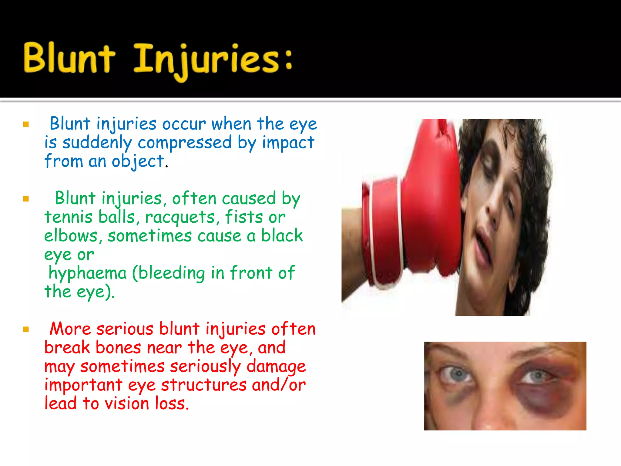 Ocular Hazards | PPTX