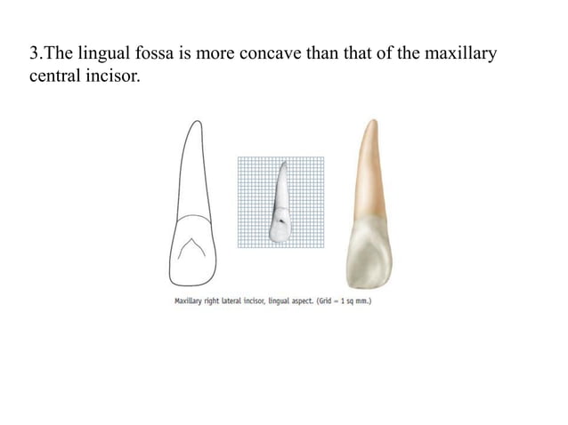Lec.5. dental anatomy 2018-Permanent Maxillary lateral Incisors # 7 ...