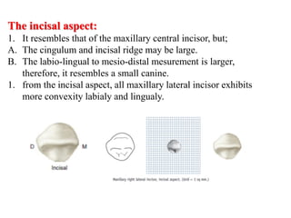 Lec.5. dental anatomy 2018-Permanent Maxillary lateral Incisors # 7 ...