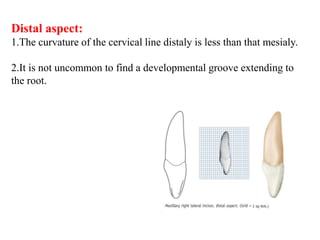 Lec.5. dental anatomy 2018-Permanent Maxillary lateral Incisors # 7 ...