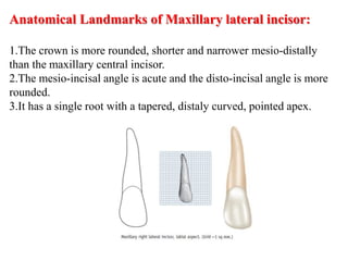 Lec.5. dental anatomy 2018-Permanent Maxillary lateral Incisors # 7 ...