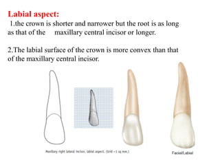 Lec.5. dental anatomy 2018-Permanent Maxillary lateral Incisors # 7 ...