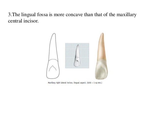 Lec.5. dental anatomy 2018-Permanent Maxillary lateral Incisors