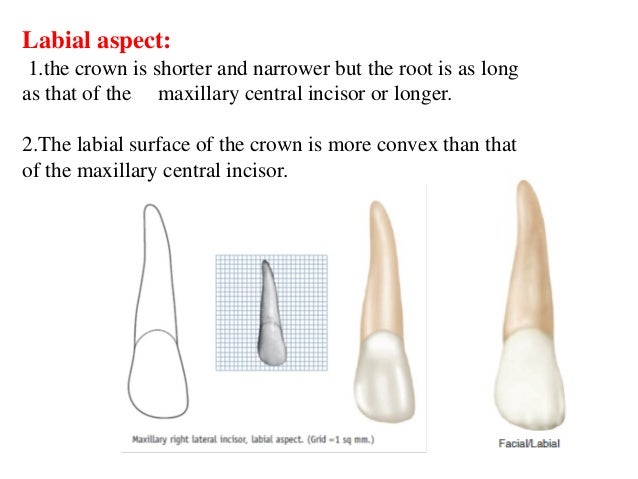 Lec.5. dental anatomy 2018-Permanent Maxillary lateral Incisors