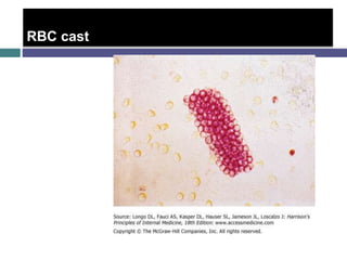 Lec. Glomerular disease (1) (2).pptx