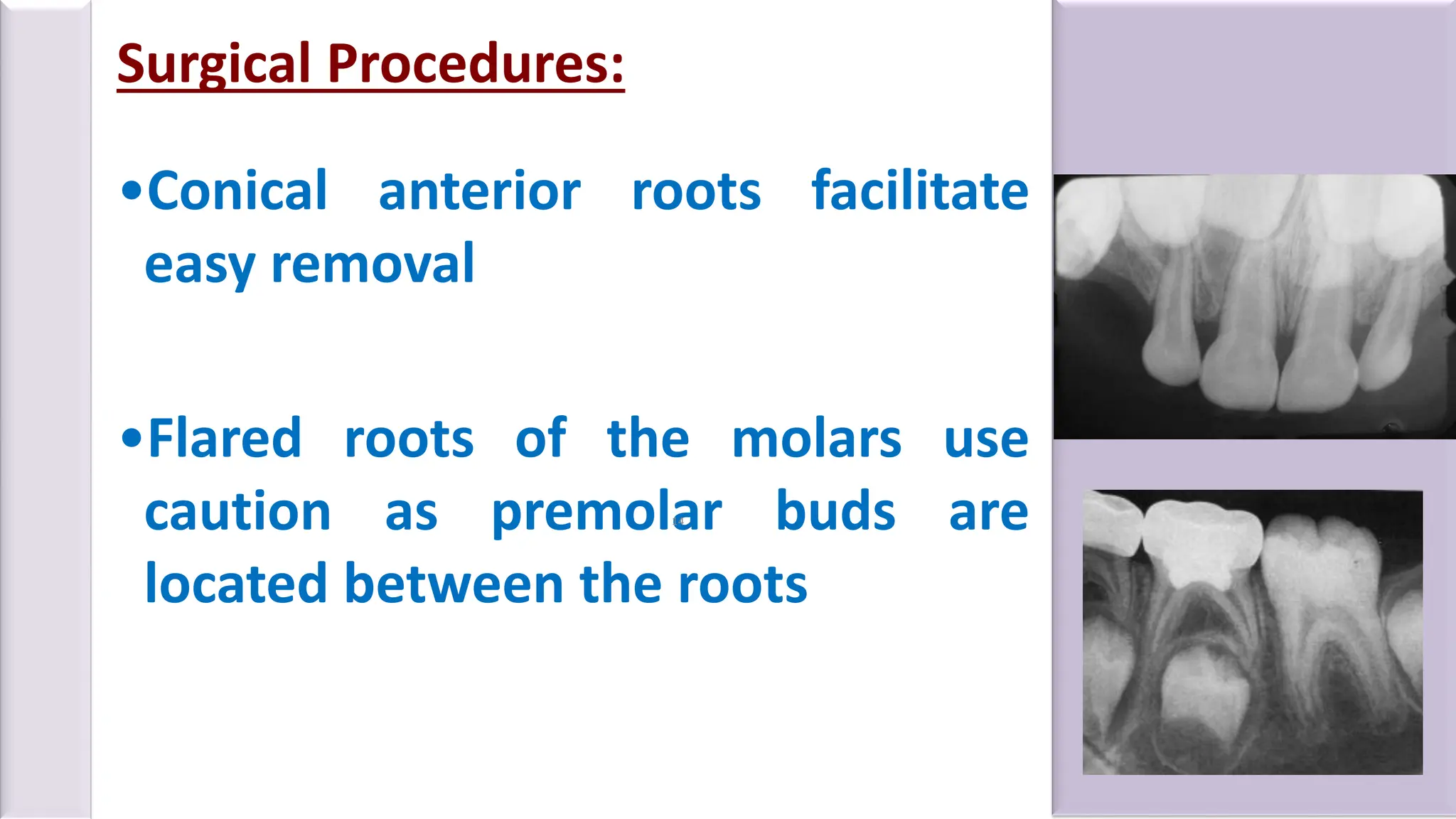 Lec.5 Morphology of the primary teeth(1).pdf