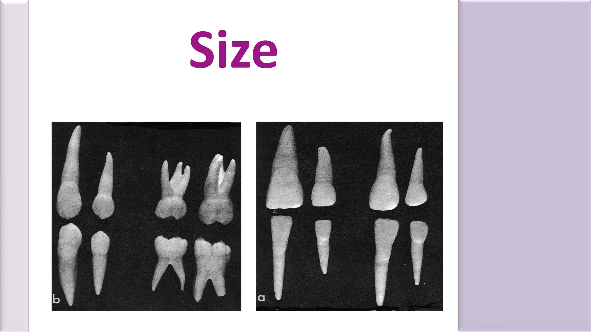 Lec.5 Morphology of the primary teeth(1).pdf