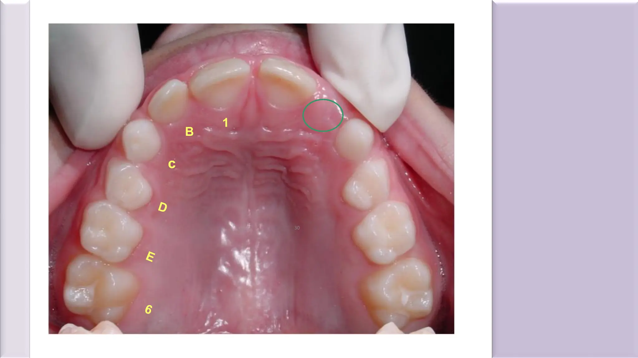 Lec.5 Morphology of the primary teeth(1).pdf