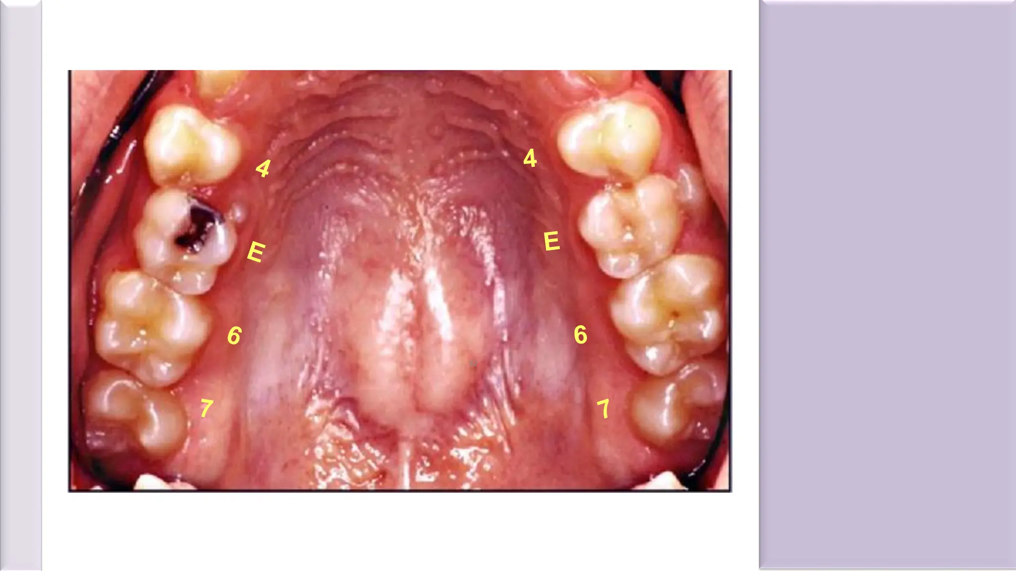 Lec.5 Morphology of the primary teeth(1).pdf