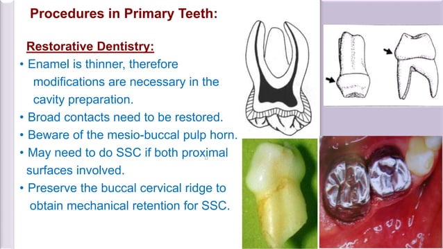 Lec.5 Morphology of the primary teeth(1).pdf