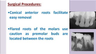 Lec.5 Morphology of the primary teeth(1).pdf