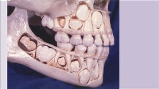 Lec.5 Morphology of the primary teeth(1).pdf