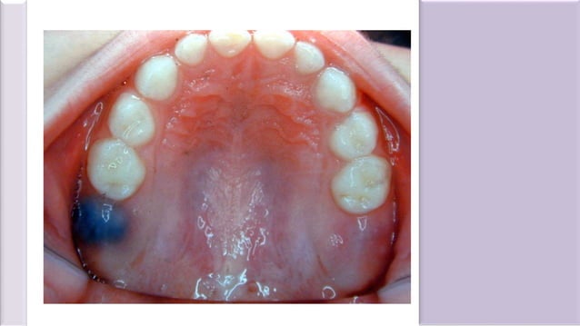 Lec.5 Morphology of the primary teeth(1).pdf