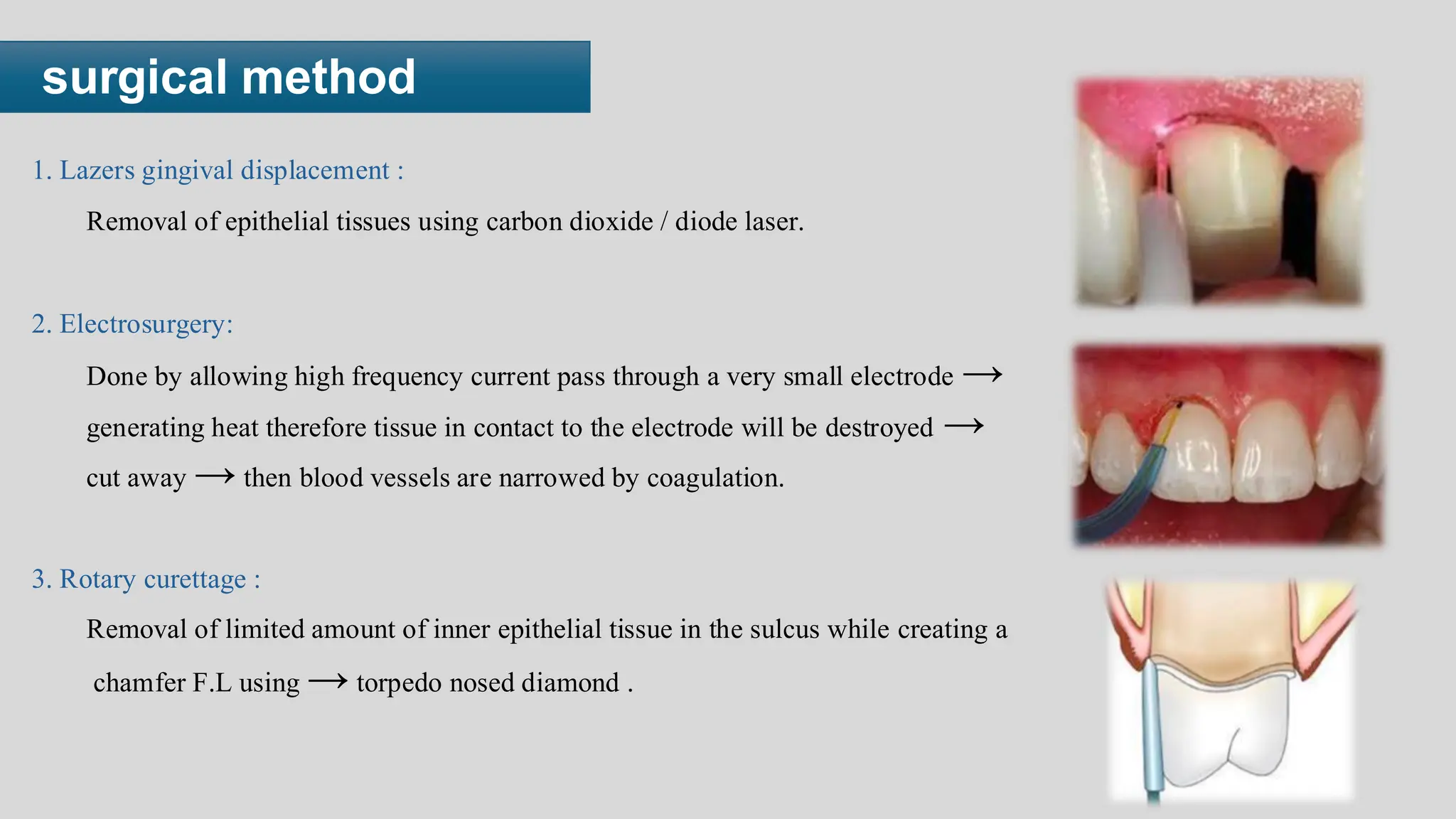 lec.1 level 3. term 2. gingival tissue displacement(1).pdf