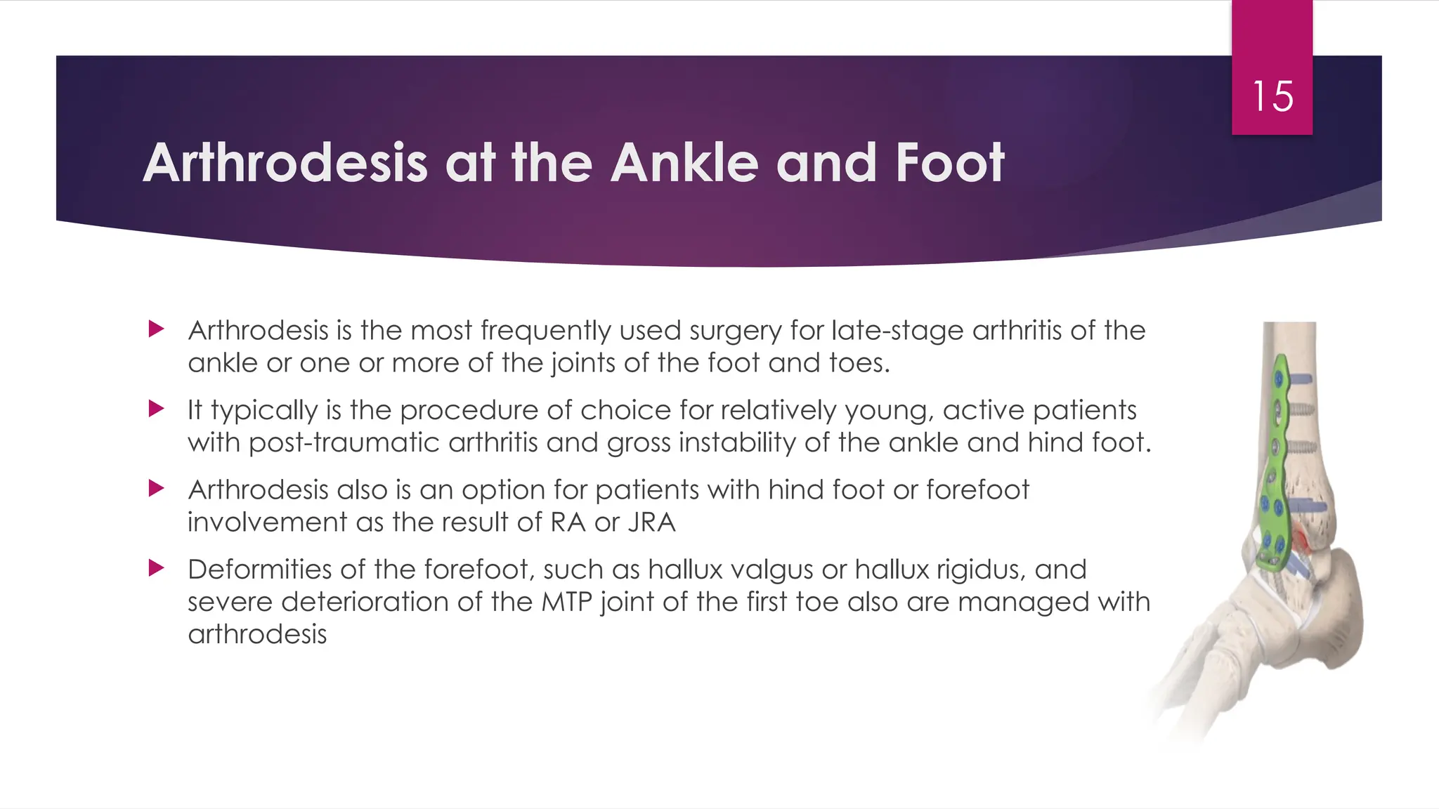 LEC.09. Ankle joint management.pptx Ankle joint management | PPTX