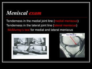 LEC.15. Knee examination.ppt Knee examination | PPT