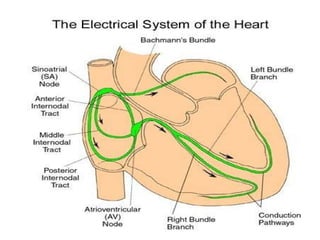 LEC.03. Basics of Electrocardiography, Arrhythmia & Pacemaker.ppt