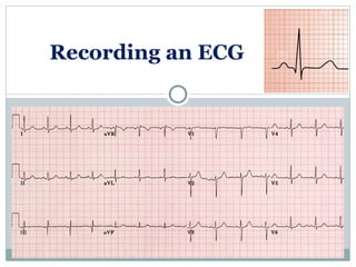 LEC.03. Basics of Electrocardiography, Arrhythmia & Pacemaker.ppt