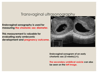 lec-3. II week of embrional development.pdf