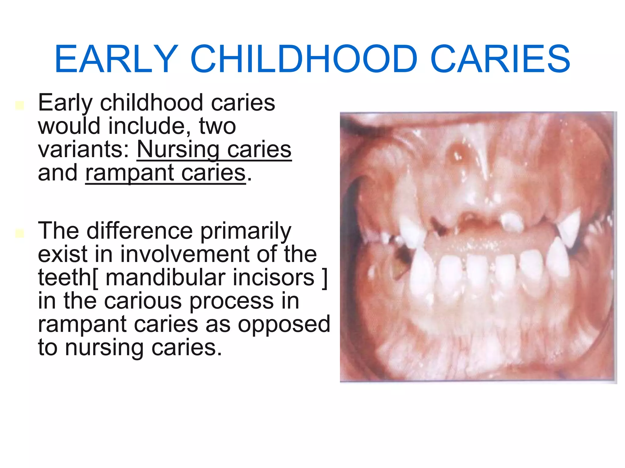 Dental caries classification.ppt