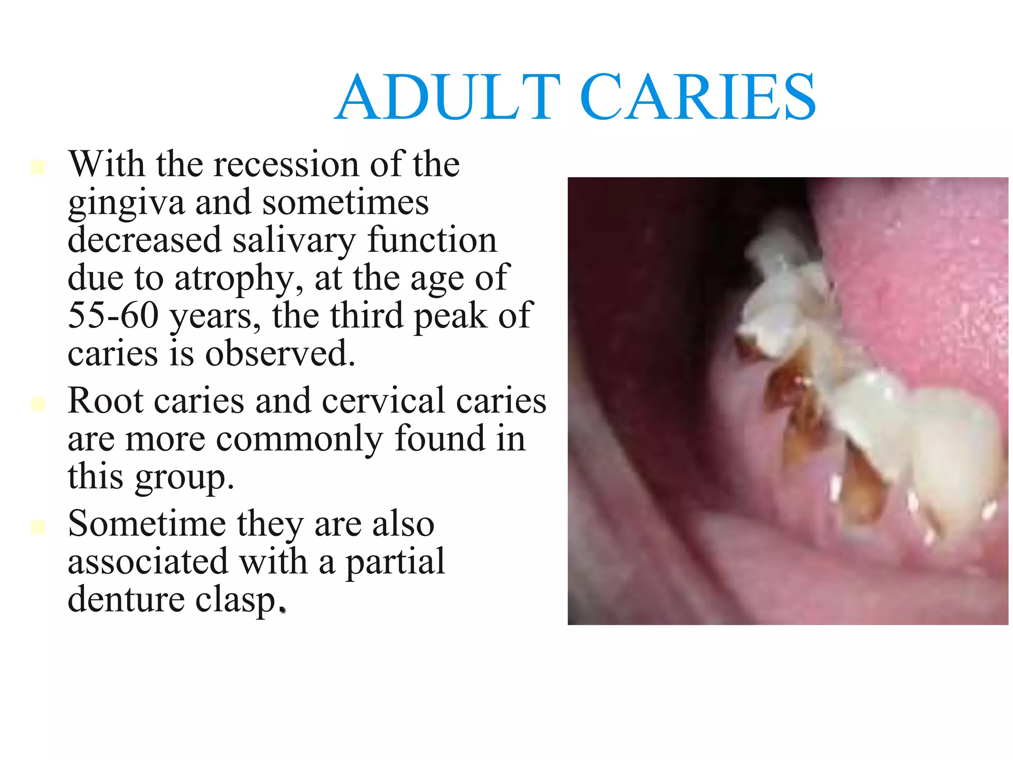 Dental caries classification.ppt