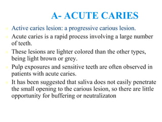 Dental caries classification.ppt