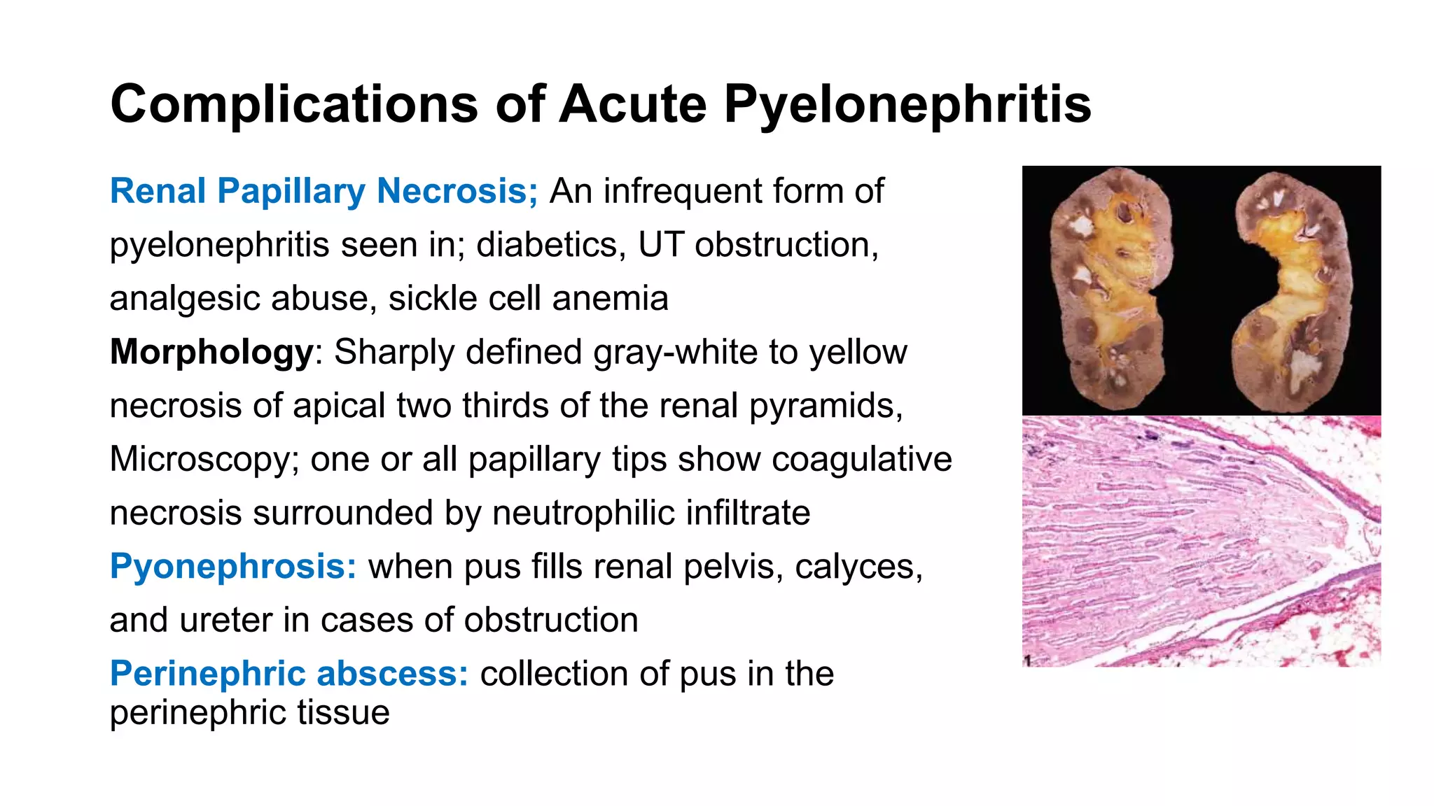 tubulointerstitial diseases- | PPTX