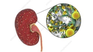 tubulointerstitial diseases- | PPTX