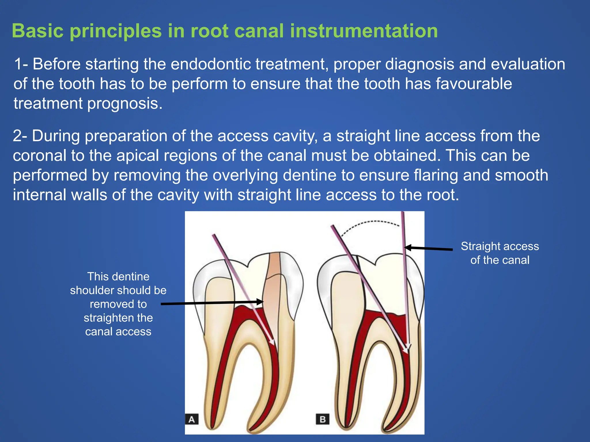 Lec-6-2021.pdf. ,,,,,dentistry endodontic. | PDF