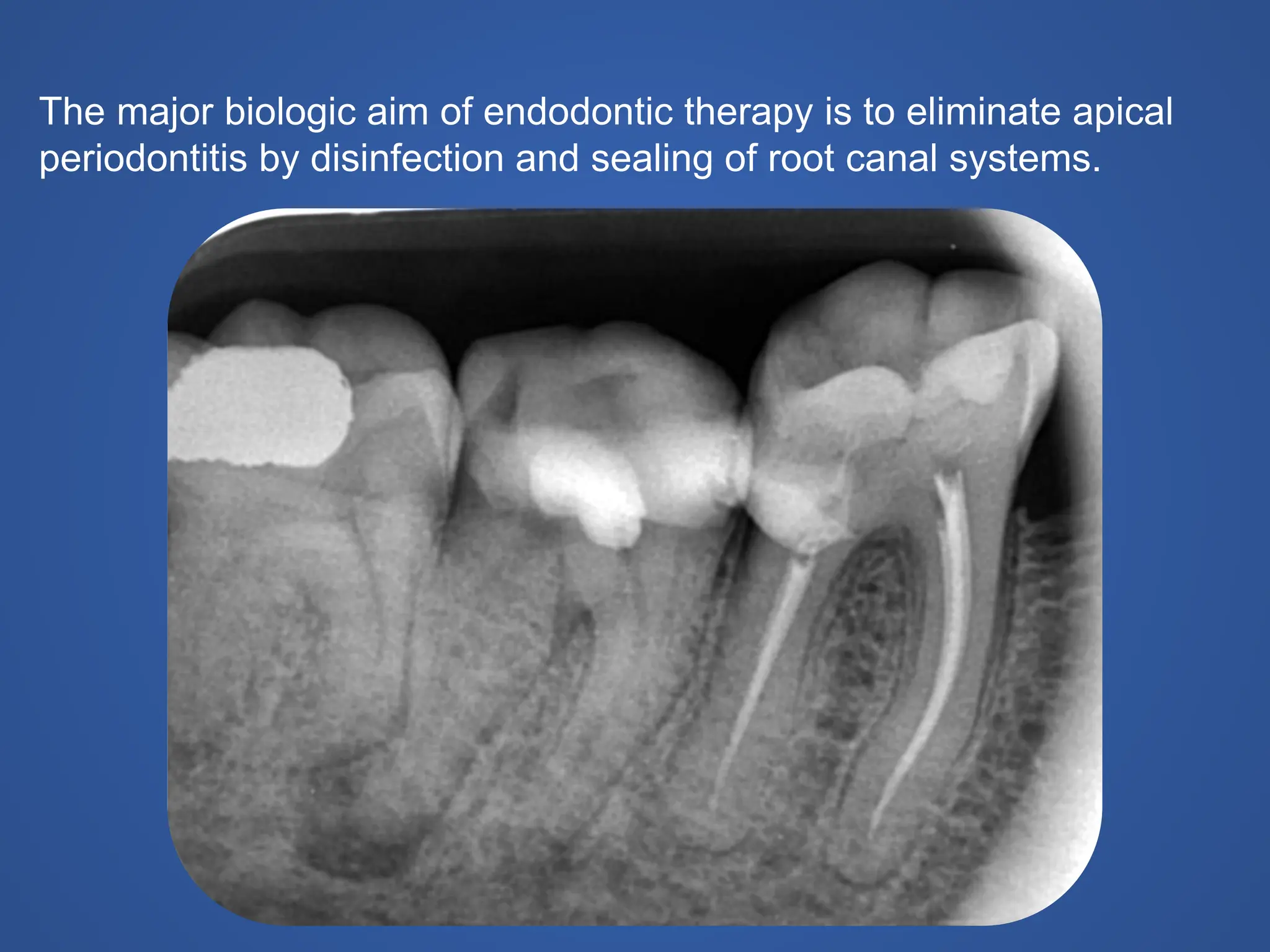 Lec-6-2021.pdf. ,,,,,dentistry endodontic. | PDF