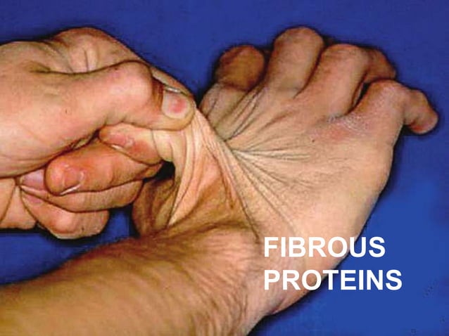 lec -6 FIBROUS PROTEINS.pptx BIOCHEMISTRTY SLIDES | PPTX | Chemistry ...