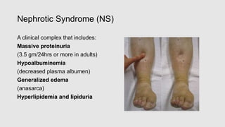 Nephrotic syndrome | PPTX