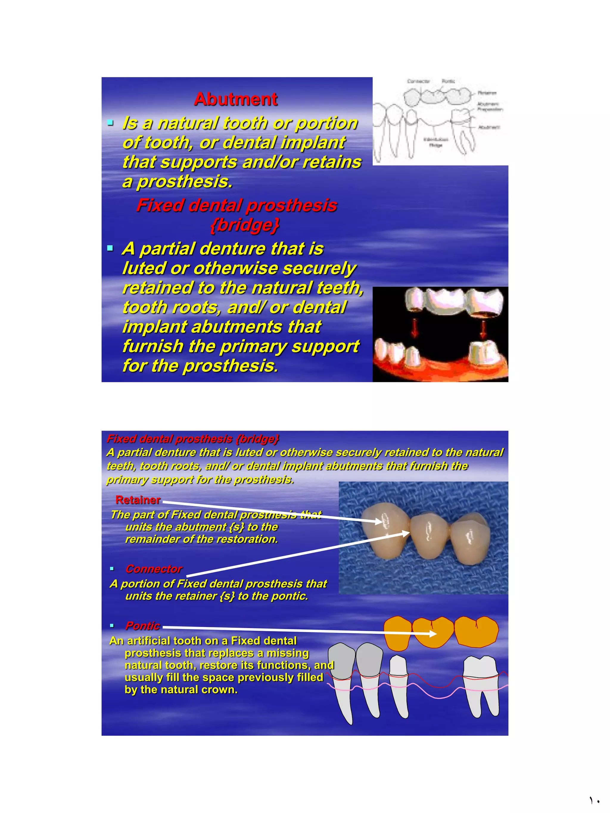 [Crown & Bridges] [terminology & classification] | PDF
