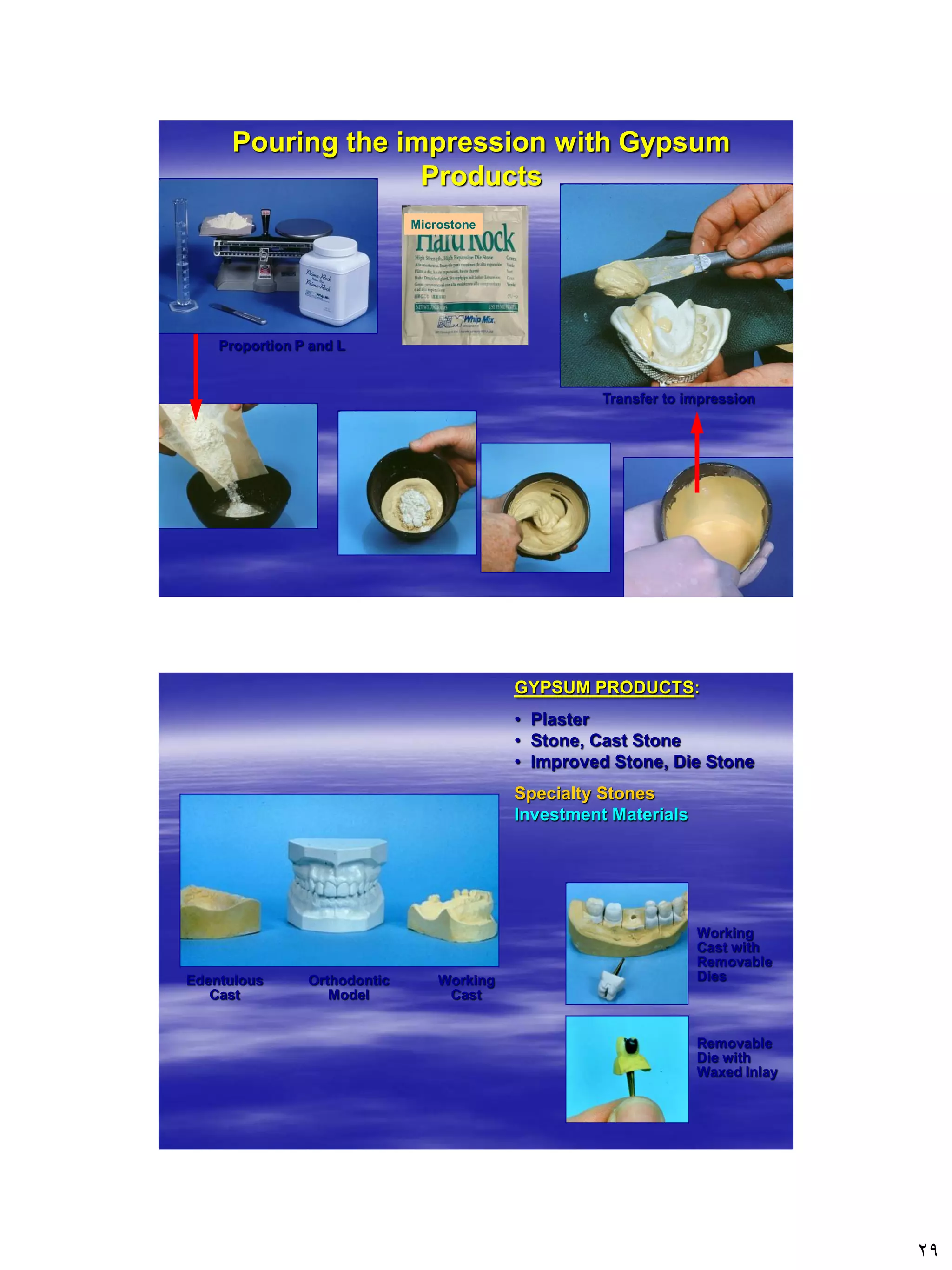 [Crown & Bridges] [terminology & classification] | PDF