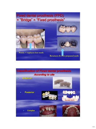[Crown & Bridges] [terminology & classification] | PDF