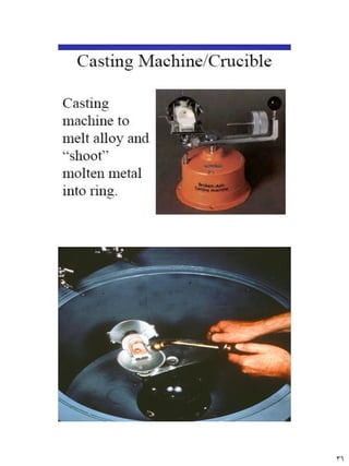 [Crown & Bridges] [terminology & classification] | PDF