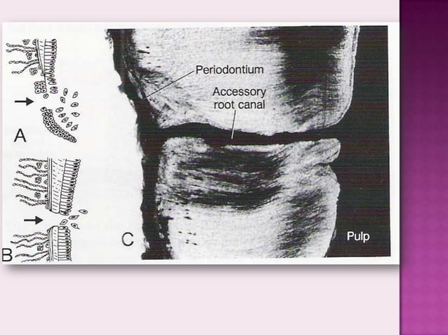 root formation tooth development | PPTX | Dental Health | Diseases and ...